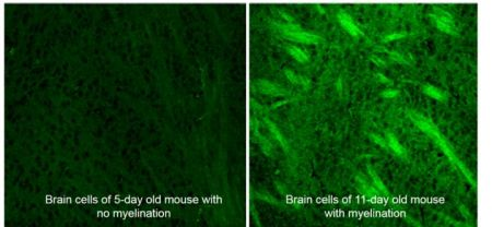 Raman imaging can track metabolic changes in living animals | Laser ...