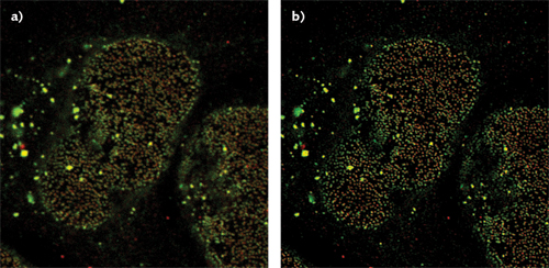 Microscopy/Image Processing: A deconvolution revolution for confocal ...