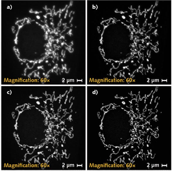Microscopy/Image Processing: A deconvolution revolution for confocal ...