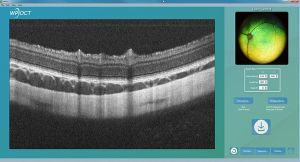 OCT software platform by Wasatch Photonics | Laser Focus World