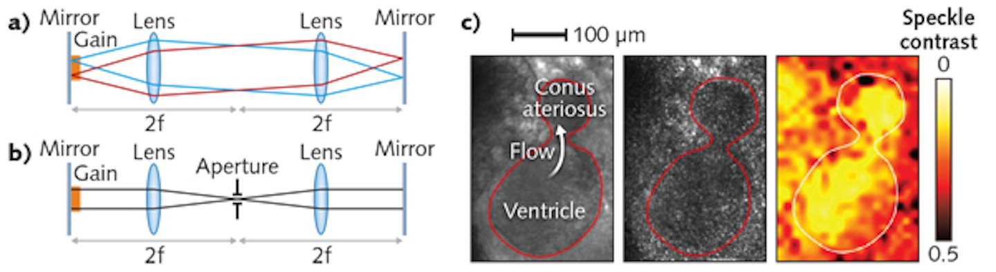 Laser Coherence: Spatial coherence engineering of lasers enhances use ...