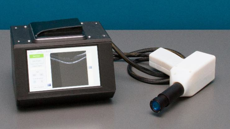 Ultralight, low-cost OCT scanner screens for retinal diseases | Laser ...
