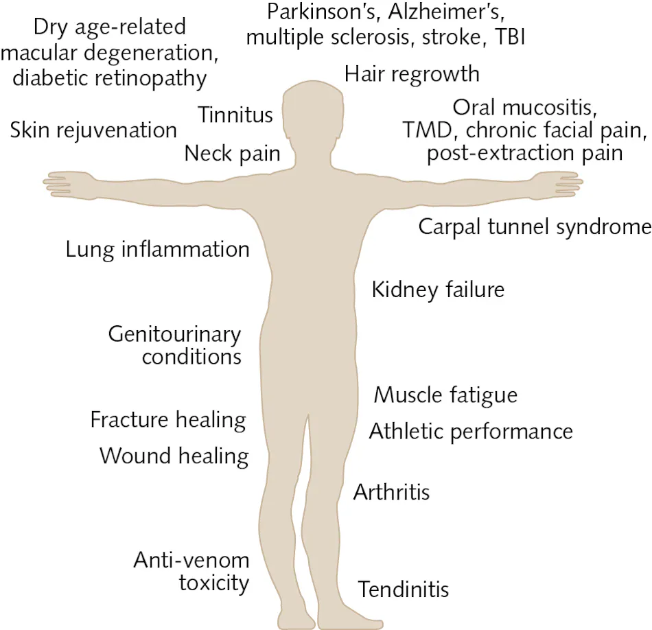 Photobiomodulation therapy—easy to do, but difficult to get right ...