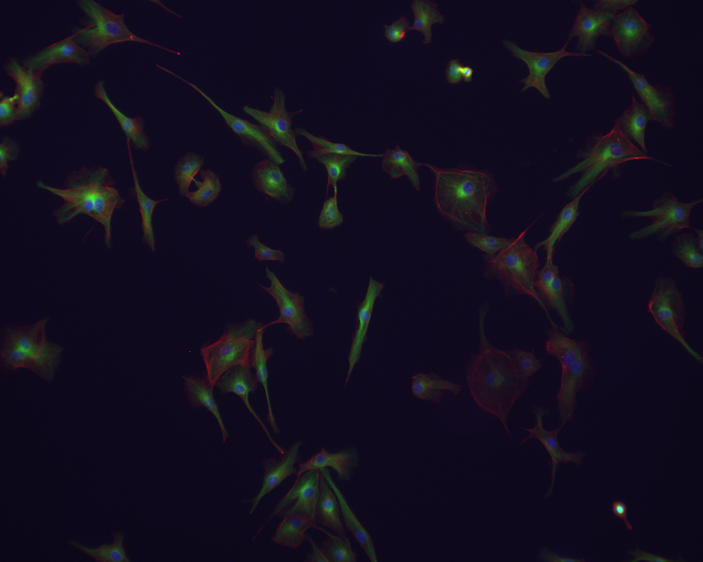 Fluorescence Microscopy: Optimizing the imaging performance of LED ...