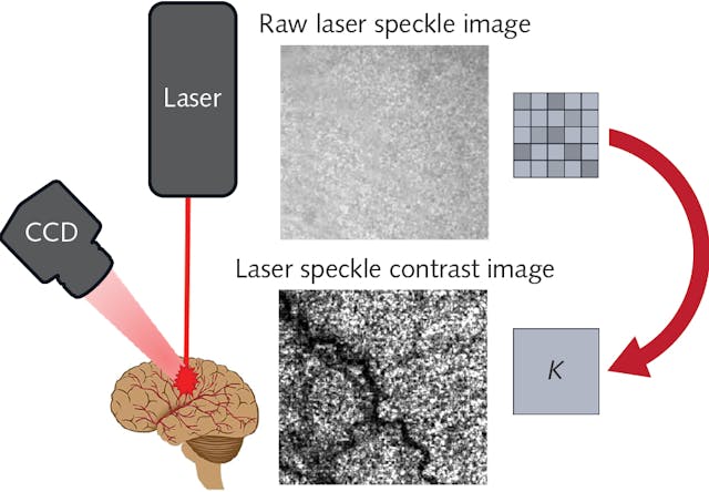 Stabilized diodes enable improved laser speckle contrast imaging ...
