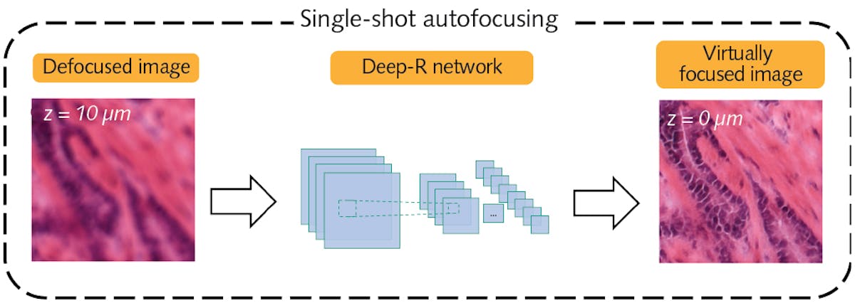 Deep learning enables single-shot autofocus in microscopy applications ...