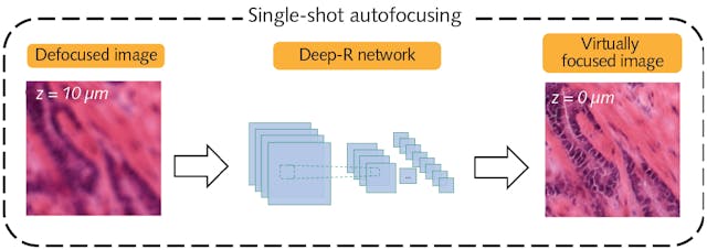 Deep learning enables single-shot autofocus in microscopy applications | Laser Focus World