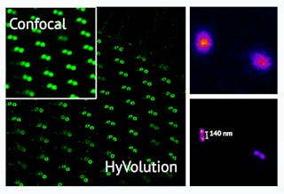 Confocal microscope add-on by Leica Microsystems | Laser Focus World
