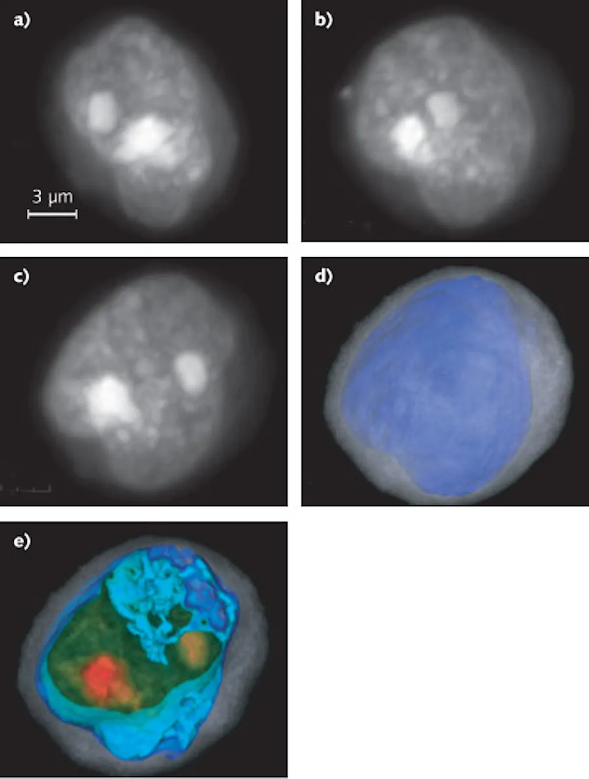 CANCER DIAGNOSIS/NANOTECHNOLOGY/SPECTROSCOPY: Biophotonics enables ...