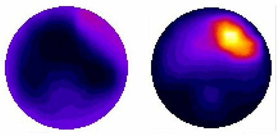 CANCER DIAGNOSIS/NANOTECHNOLOGY/SPECTROSCOPY: Biophotonics enables ...