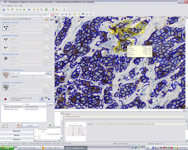 Cell analysis software module by Olympus | Laser Focus World