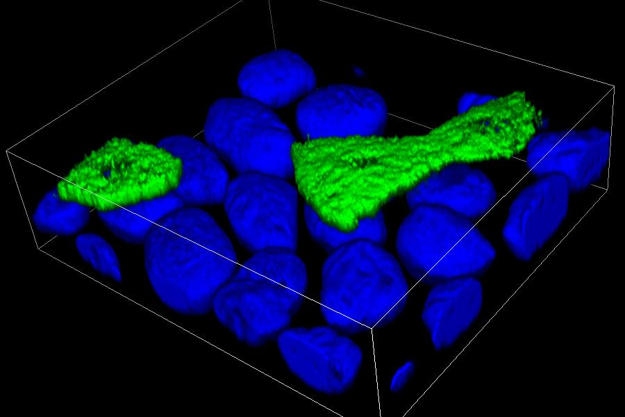 Microscopy tracks transport of proteins in living cells | Laser Focus World