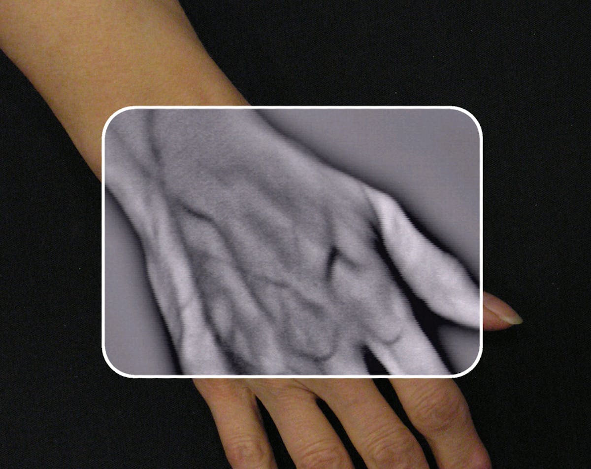 BIOMEDICAL DEVICE DESIGN & DEVELOPMENT: Borrowed components for cost ...