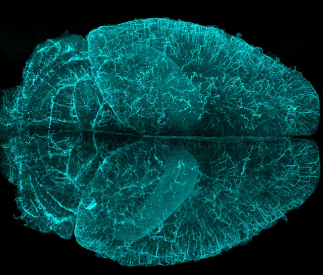 Microscopy image analysis software features new functionalities | Laser ...