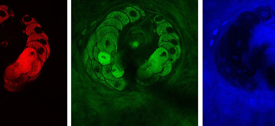 CELL BIOLOGY/RAMAN SPECTROSCOPY: Label-free, subcellular images ...