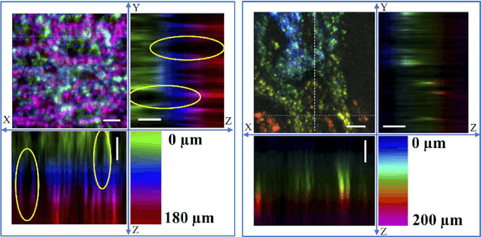 Chromatic aberration aids in-depth imaging of biological tissue | Laser ...