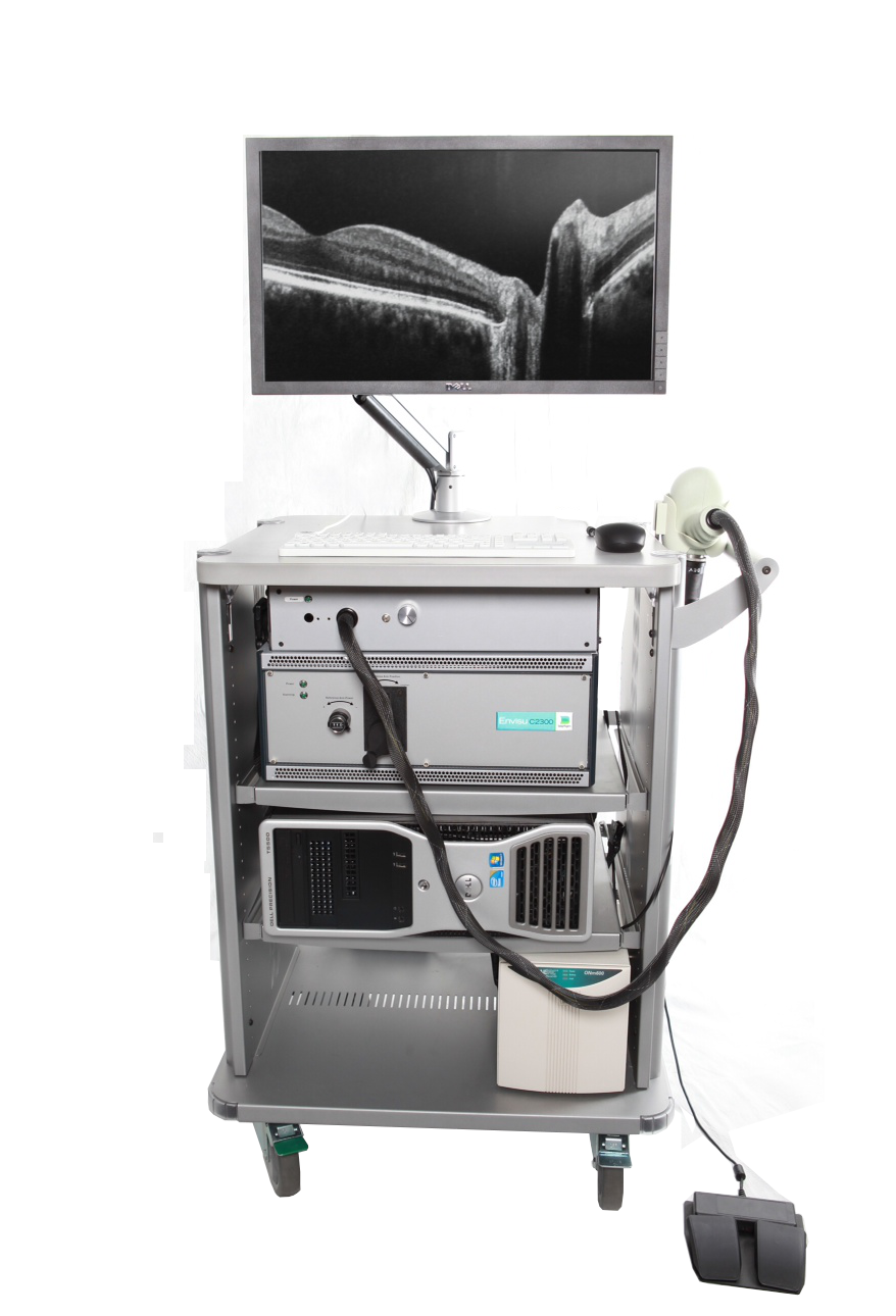 OPTICAL COHERENCE TOMOGRAPHY/OPHTHALMOLOGY: Intraoperative OCT improves ...