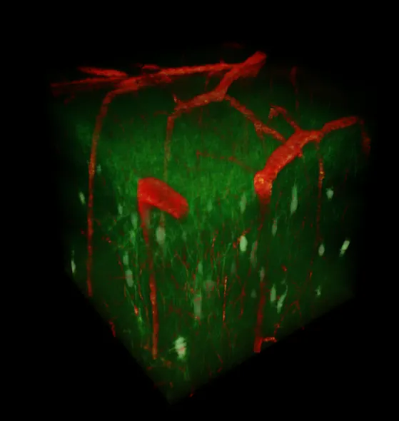NEUROSCIENCE/BIOPHOTONICS: The BRAIN Initiative: Opportunities for ...
