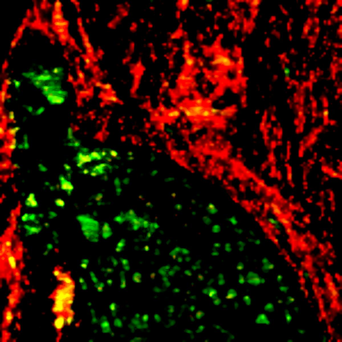 Bioimaging advance aids creation of enhanced clinical devices | Laser ...