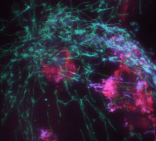 Next-generation microscope boosts opportunities | Laser Focus World