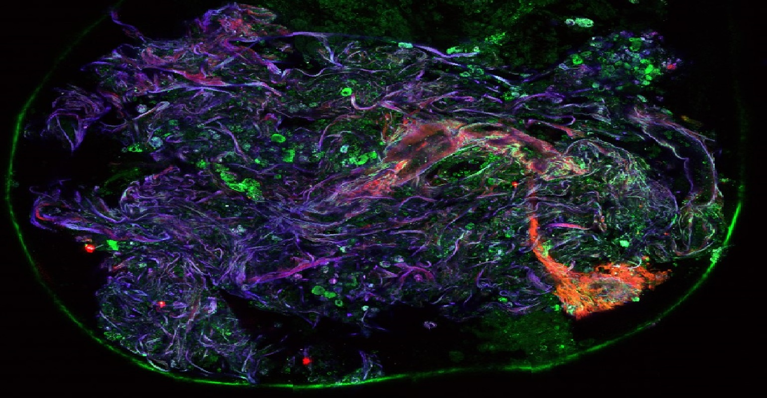 Advantages of sub 50 femtosecond pulses in multiphoton microscopy ...