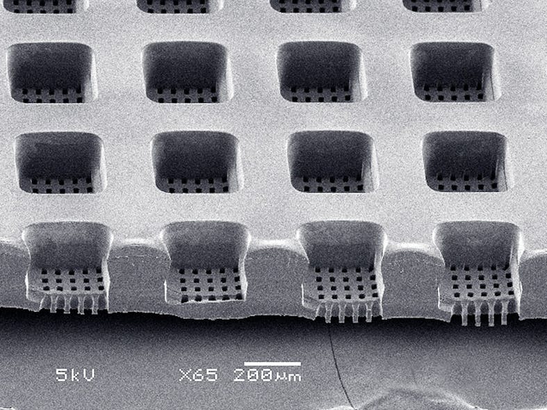 The expanding role of excimer lasers | Laser Focus World