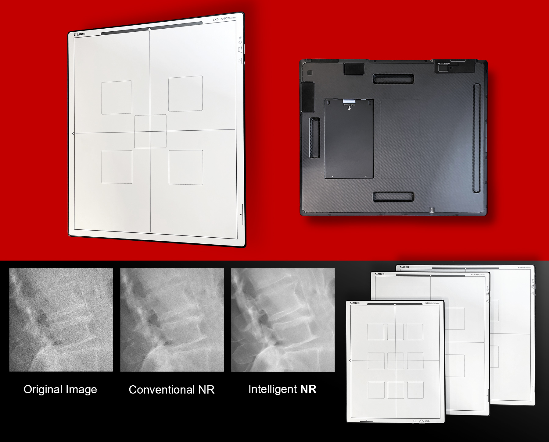 Wireless flat-panel detectors suited for mobile applications | Laser ...