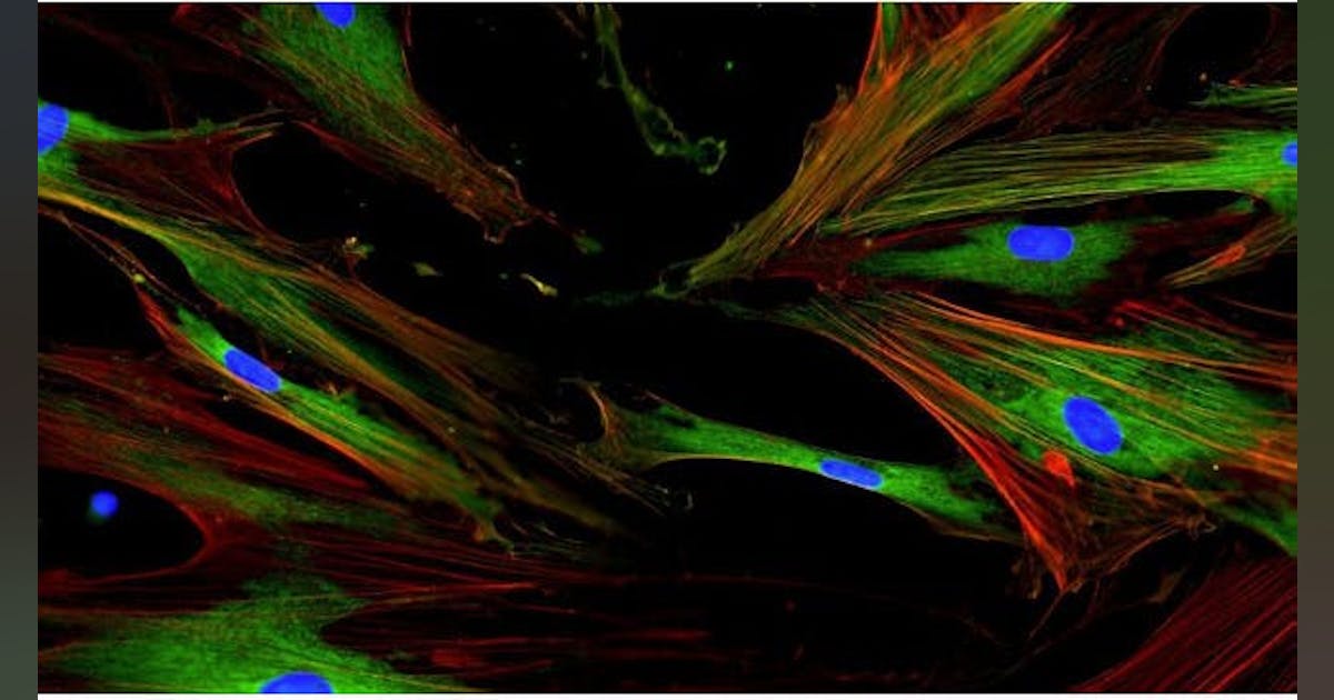 Live Cell Imaging With Advanced Microscope Technology Laser Focus World