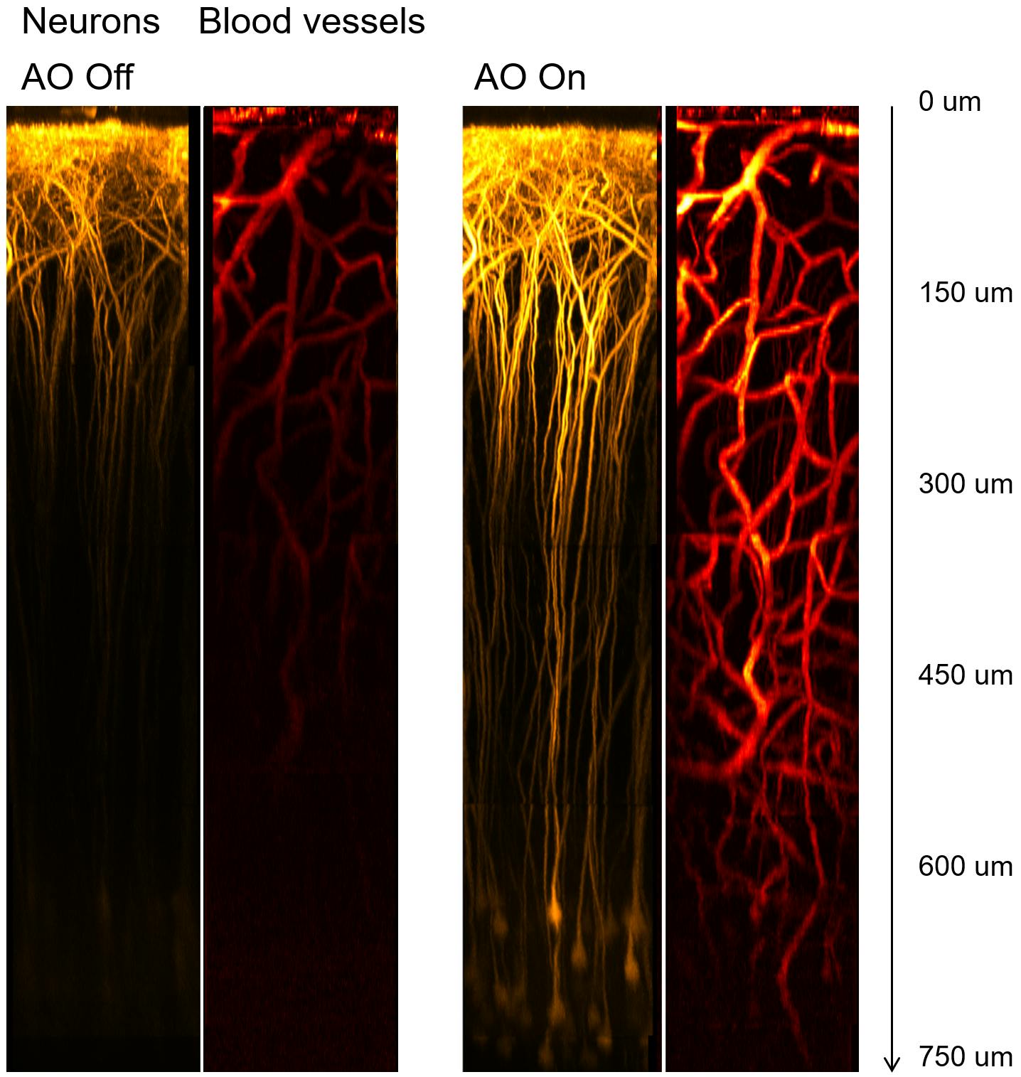 Three-photon microscopy comes of age | Laser Focus World