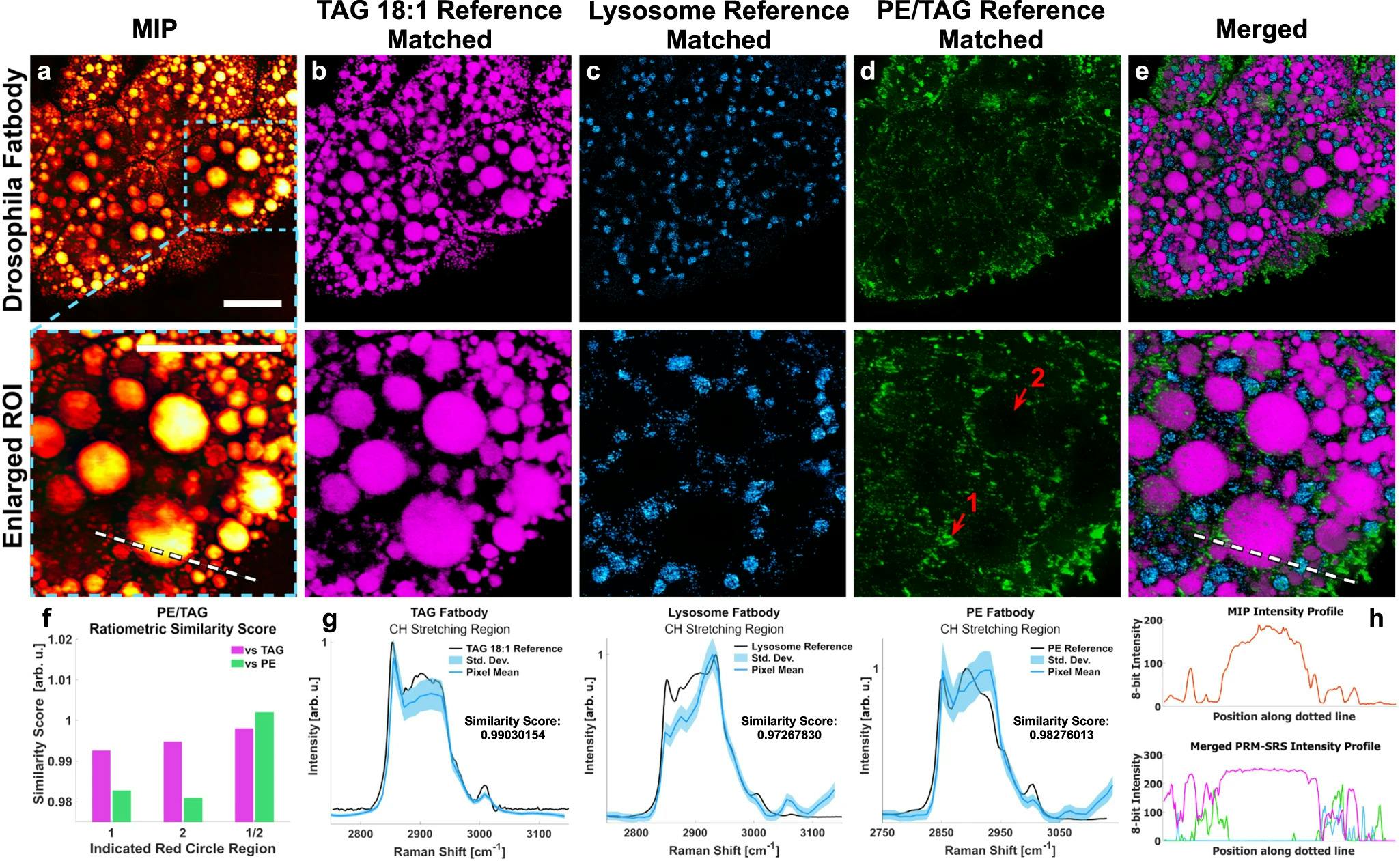 PRM-SRS microscopy platform distinguishes specific lipid types | Laser ...